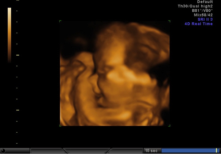 CIVIS VITA - GALERIA USG 3D - GALERIA USG TORUŃ, GALERIA USG 3D TORUŃ ...